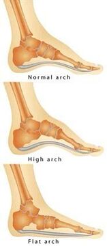 Foot Clinik